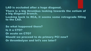 Primary pci | PPTX