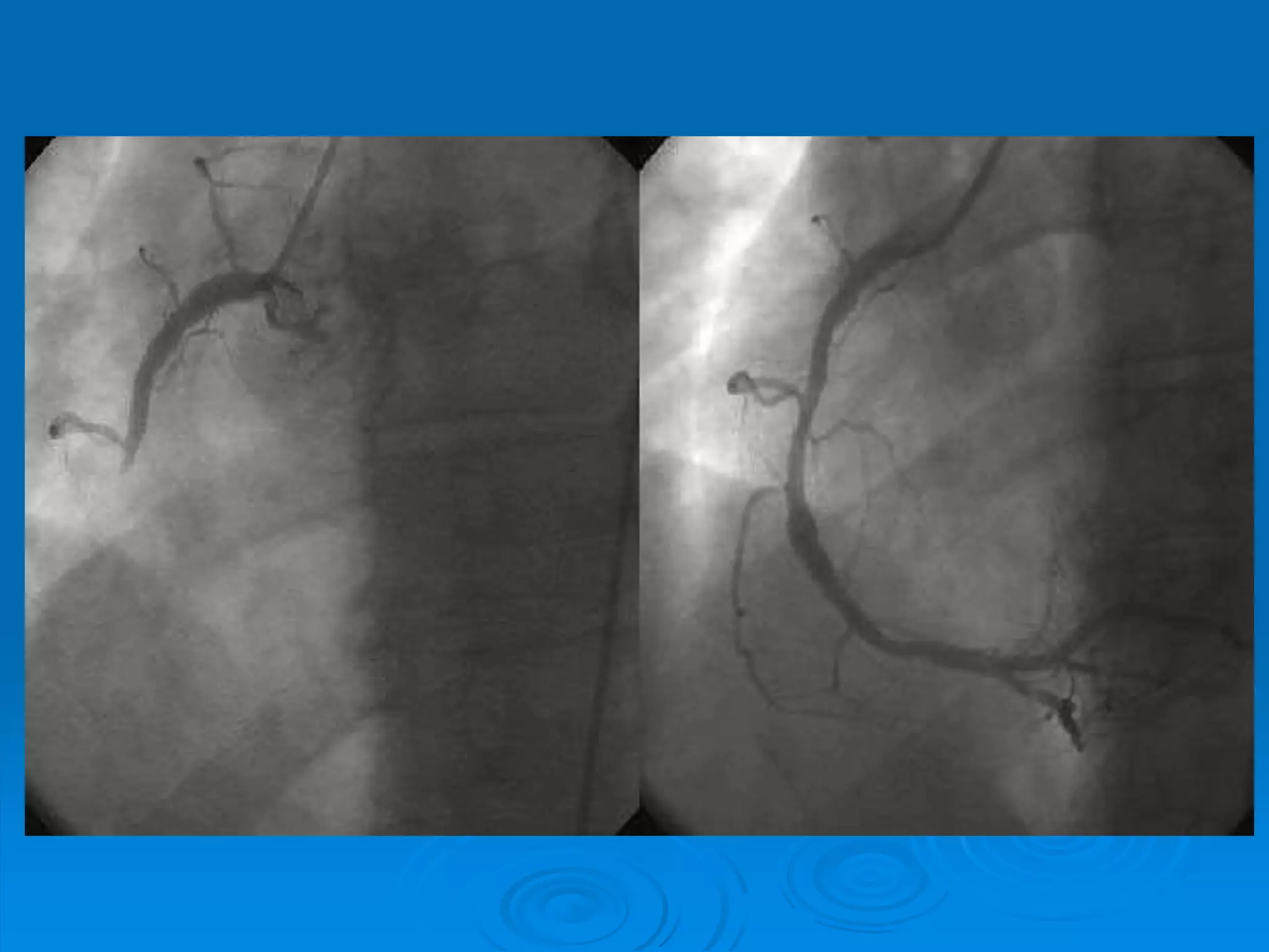 Primary pci management | PPT