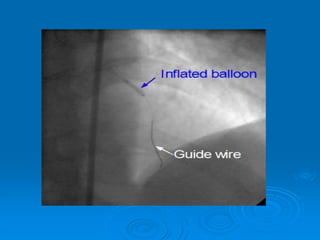 Primary pci management | PPT