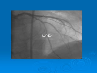 Primary pci management | PPT
