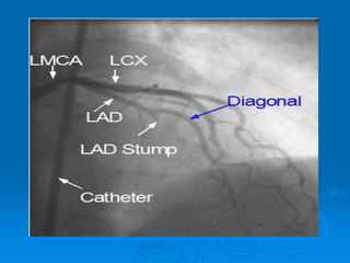 Primary pci management | PPT