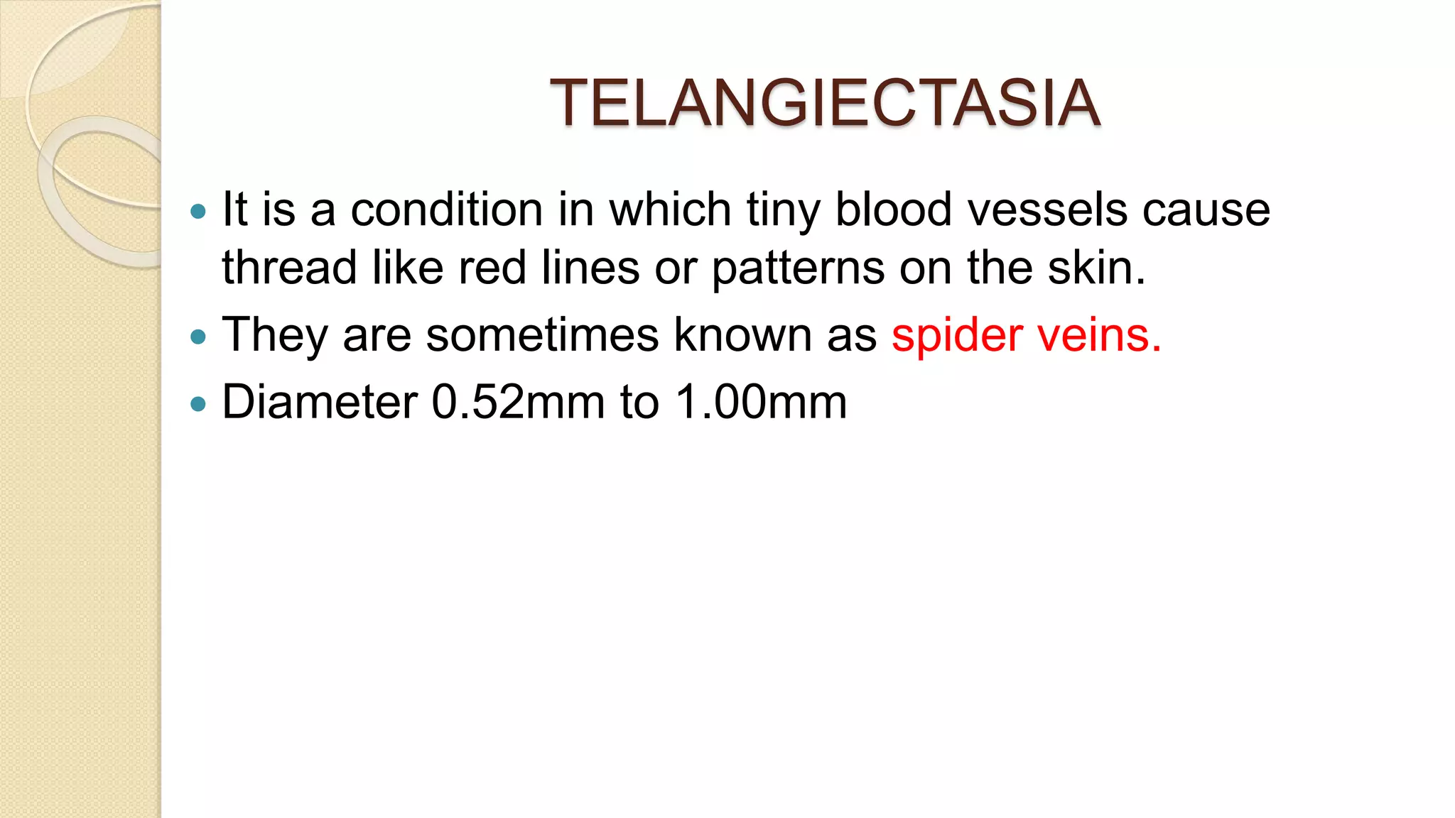 Primary Retinal Telangiectasia | PPTX