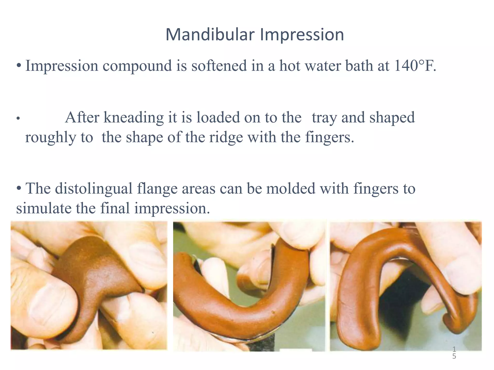 PRIMARY & SECONDARY IMPRESSION IN CD.ppt