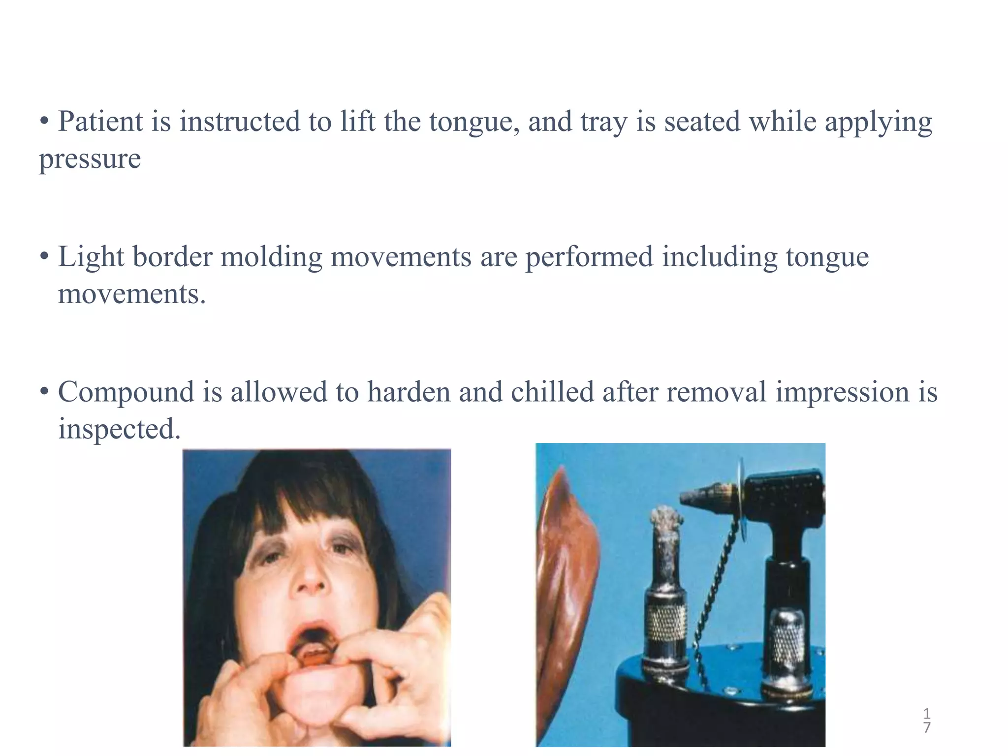PRIMARY & SECONDARY IMPRESSION IN CD.ppt