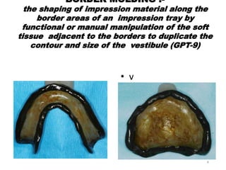 PRIMARY & SECONDARY IMPRESSION IN CD.ppt