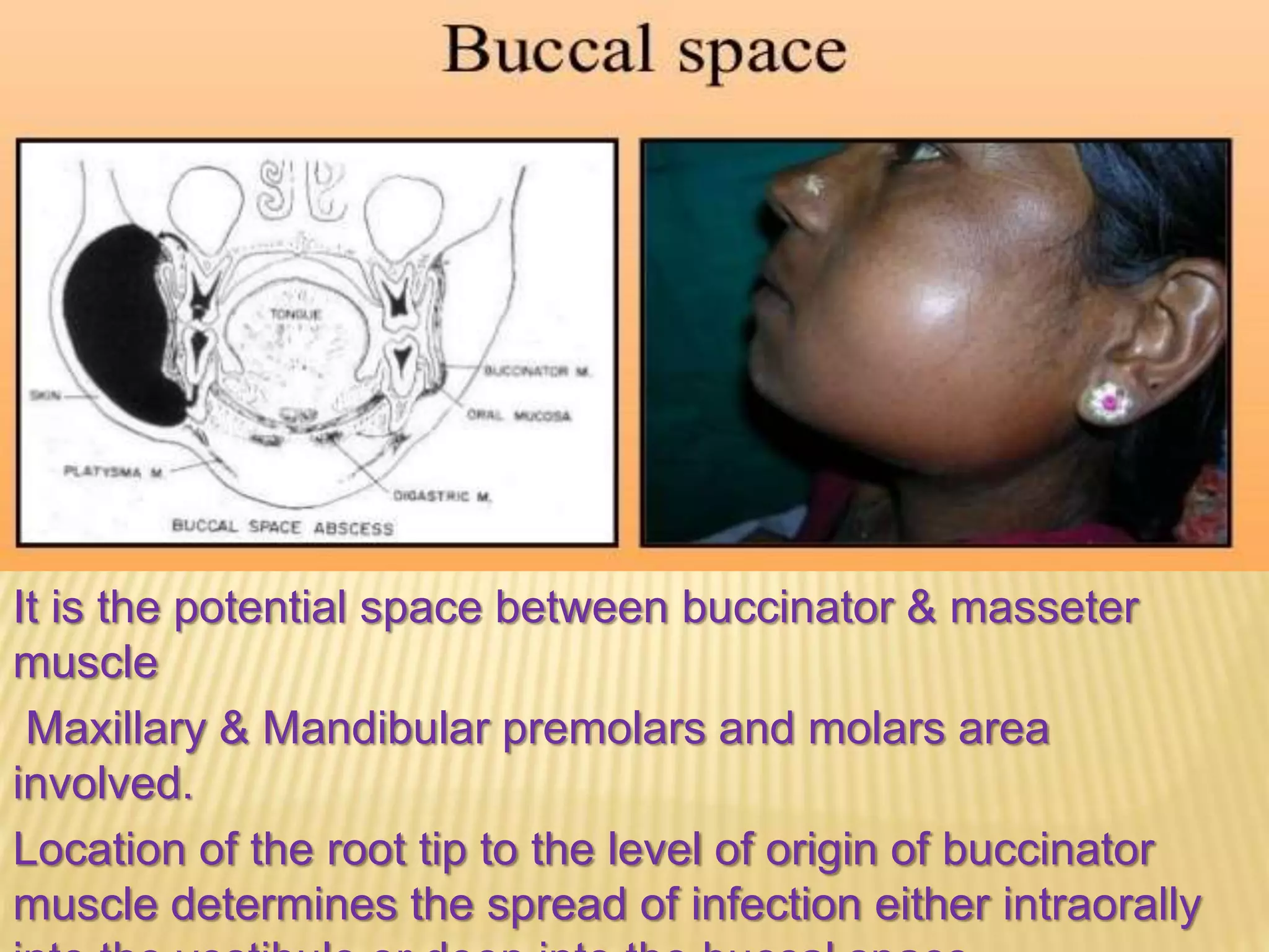 Primary spaces of space infection | PPTX