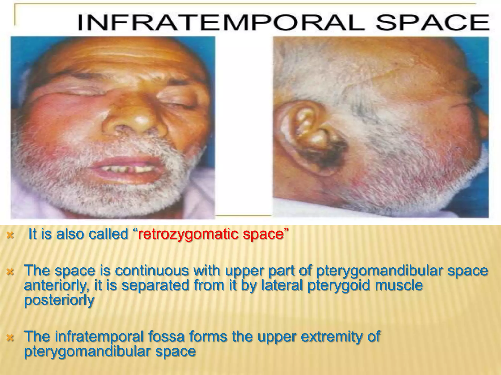 Primary spaces of space infection | PPTX