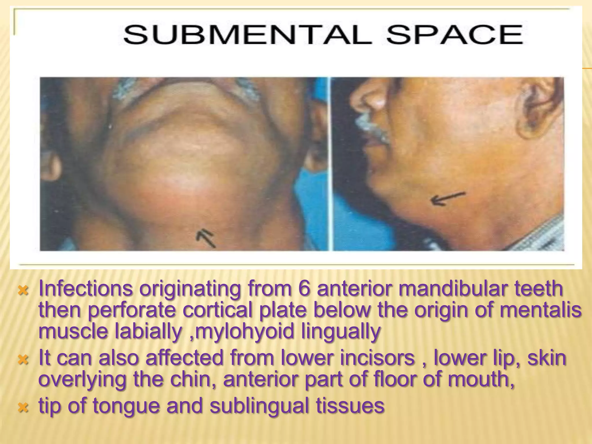 Primary spaces of space infection | PPTX