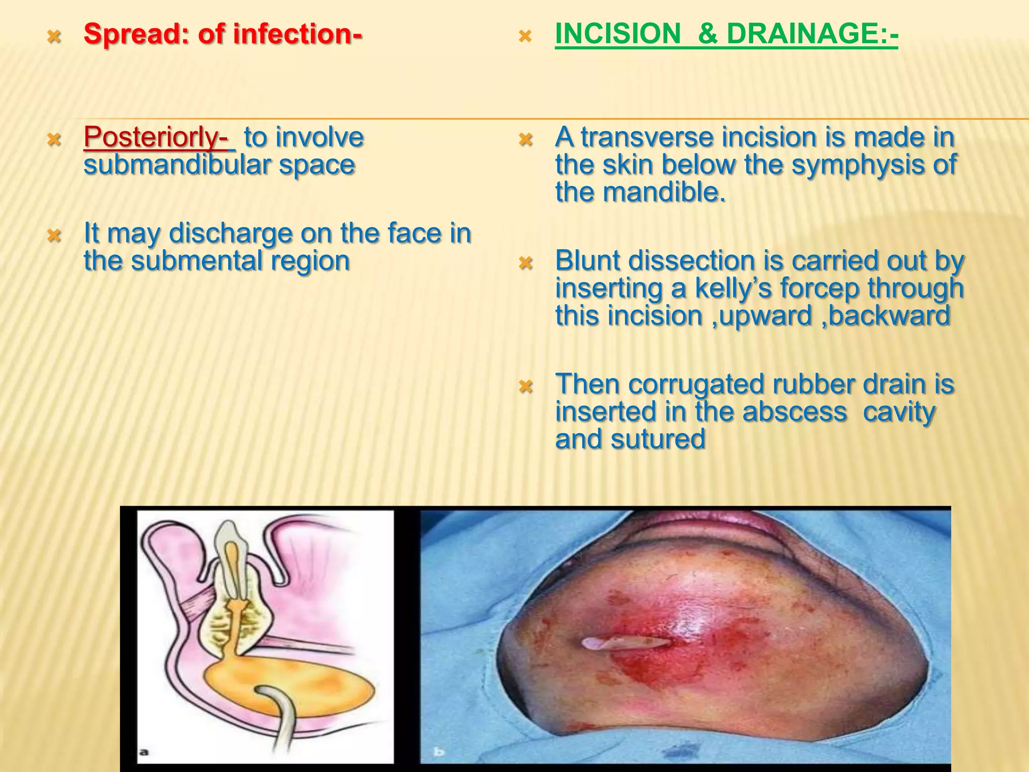 Primary spaces of space infection | PPTX