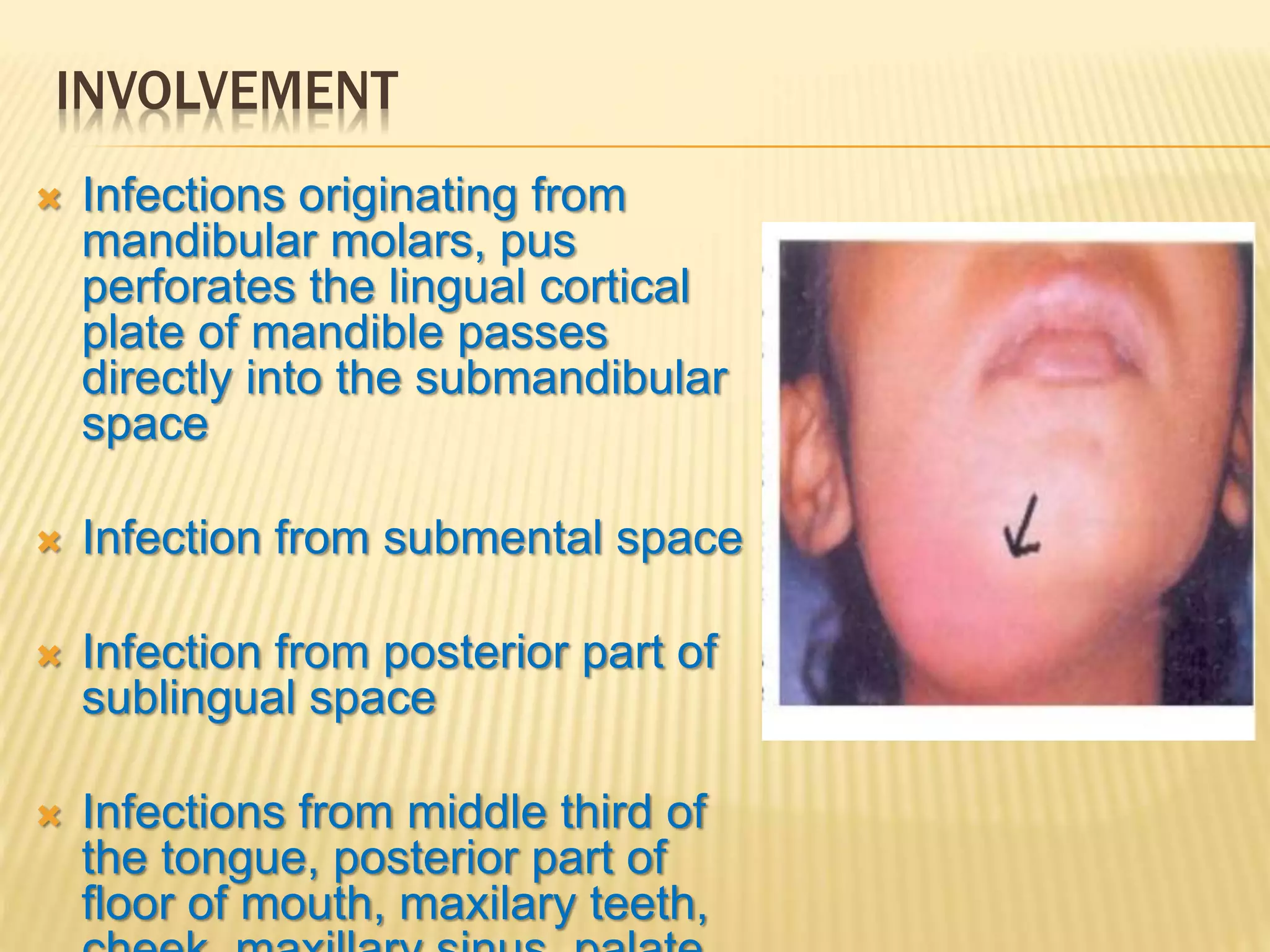Primary spaces of space infection | PPTX