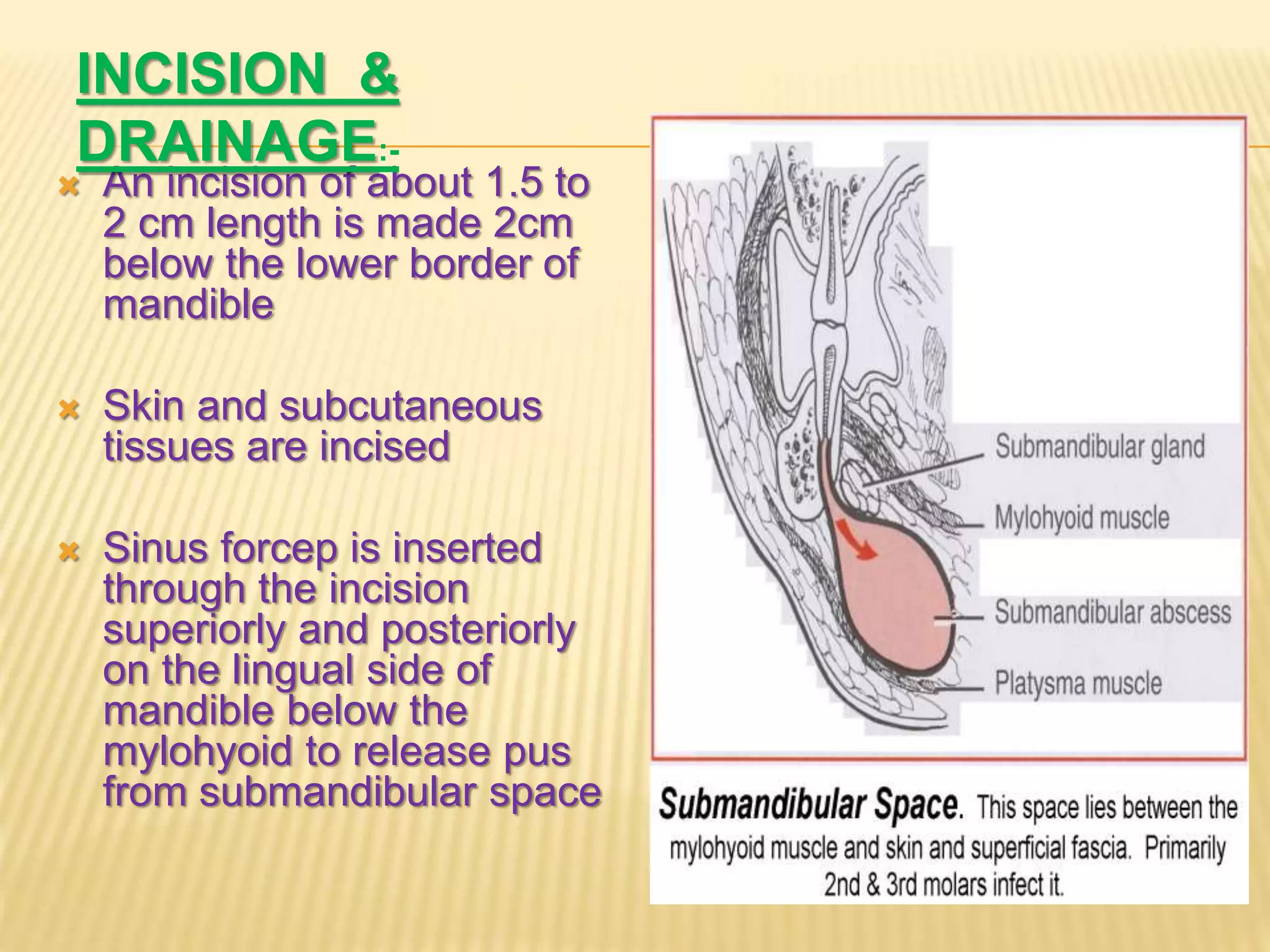 Primary spaces of space infection | PPTX