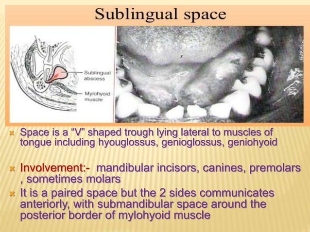 Primary spaces of space infection | PPTX | Ear, Nose and Throat ...