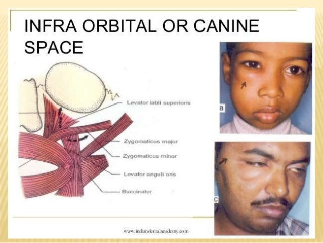 Primary spaces of space infection