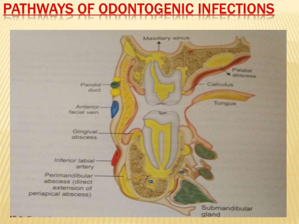 Primary spaces of space infection