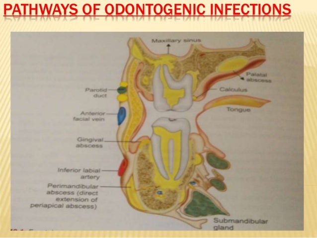 Primary spaces of space infection