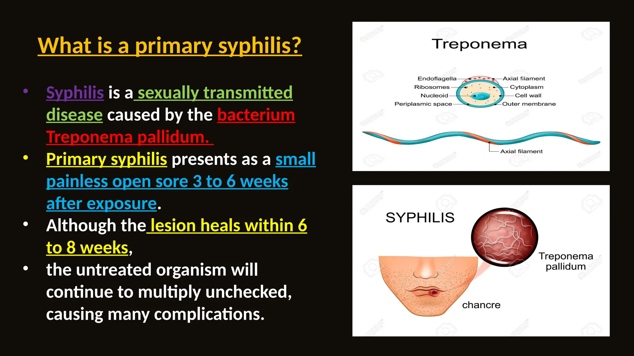 Primary syphilis in terms of medicine and life | PPTX