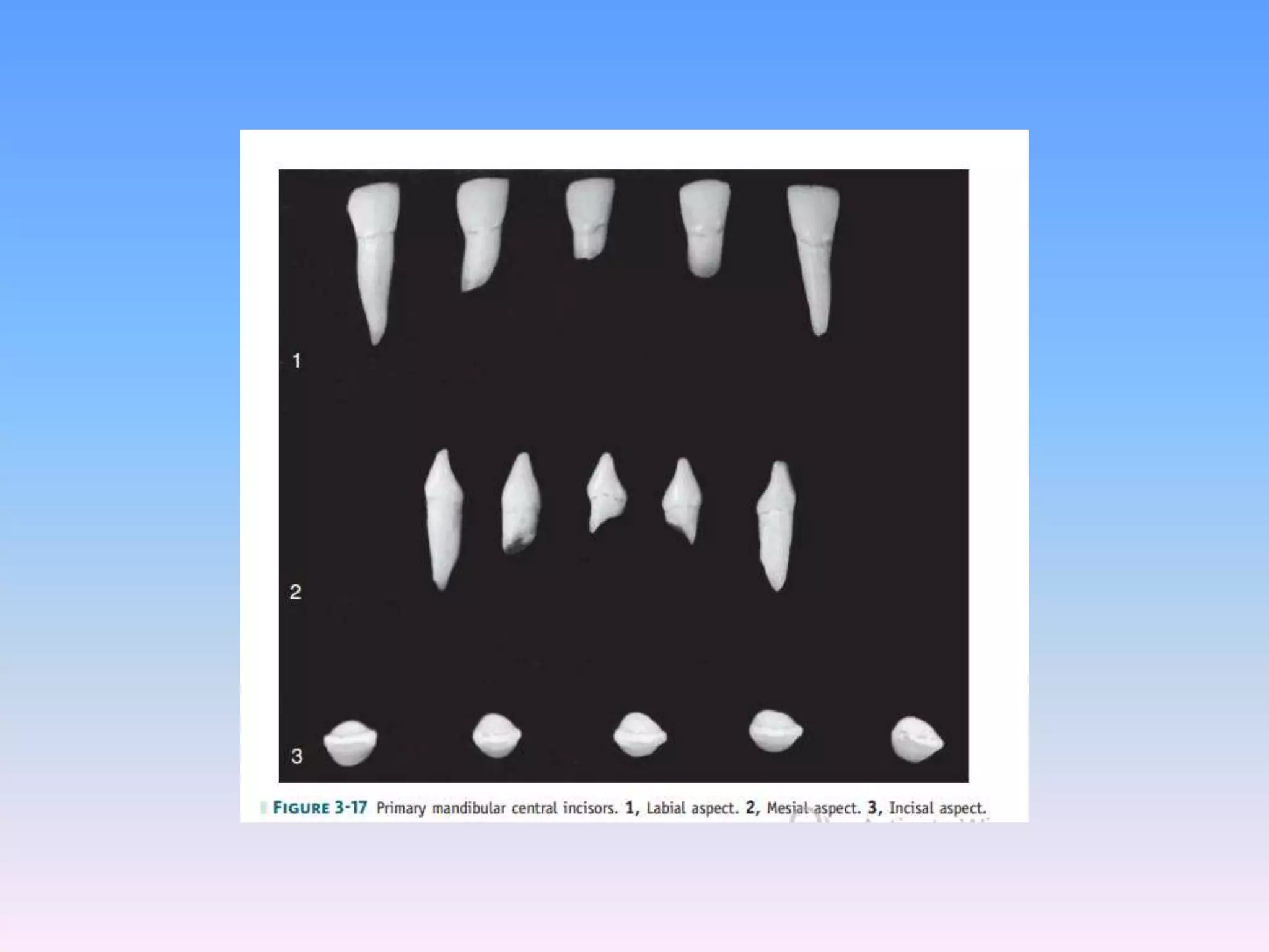 Primary teeth original | PPT