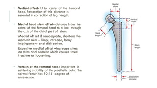 Primary total hip arthroplasty - IMPLANTS | PDF