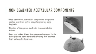 Primary total hip arthroplasty - IMPLANTS | PDF