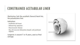 Primary total hip arthroplasty - IMPLANTS | PPT