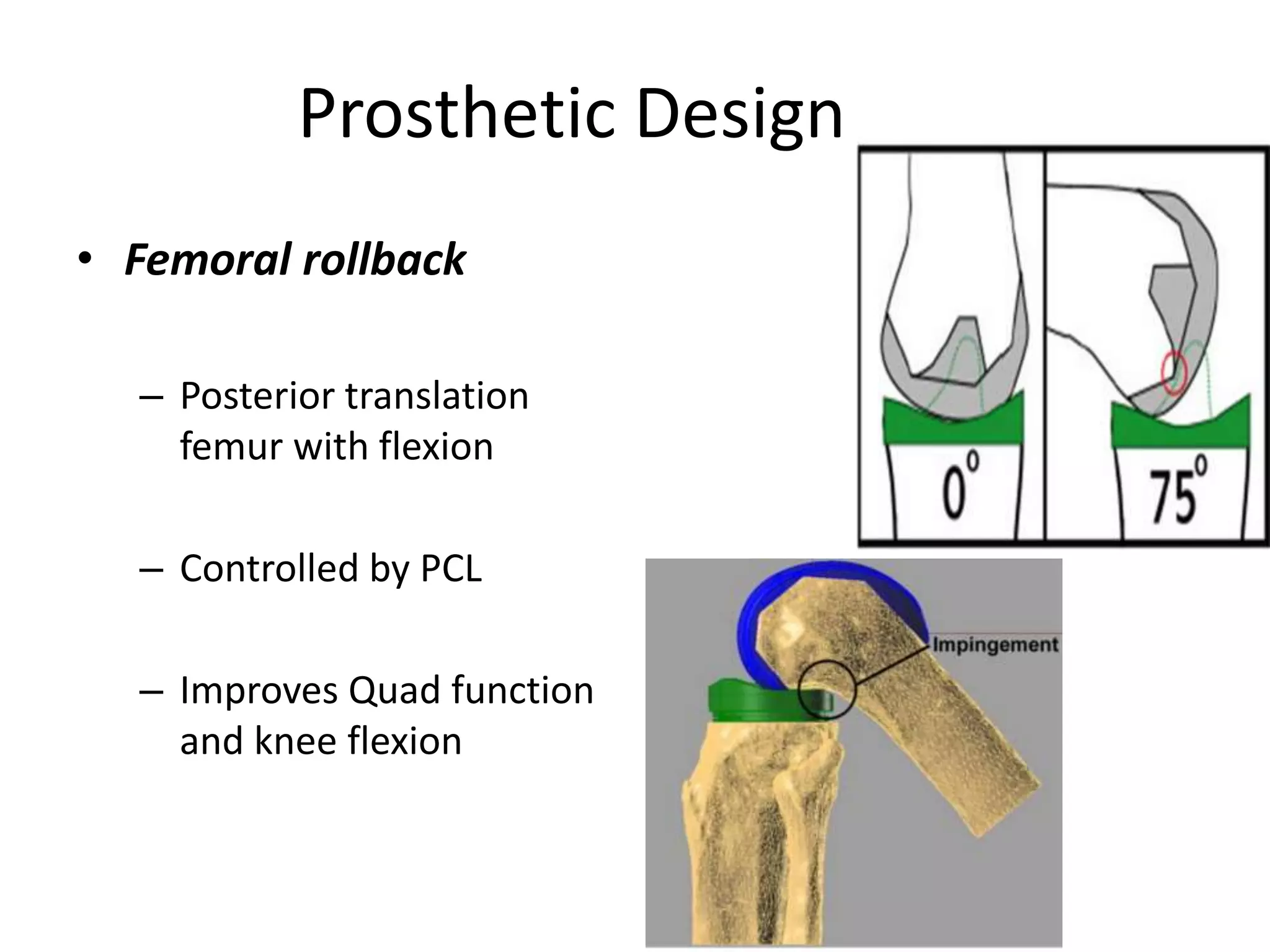 Primary total knee arthroplasty | PPTX