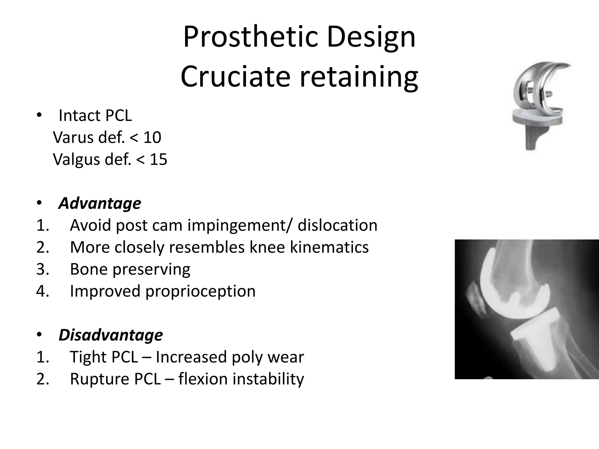 Primary total knee arthroplasty | PPTX