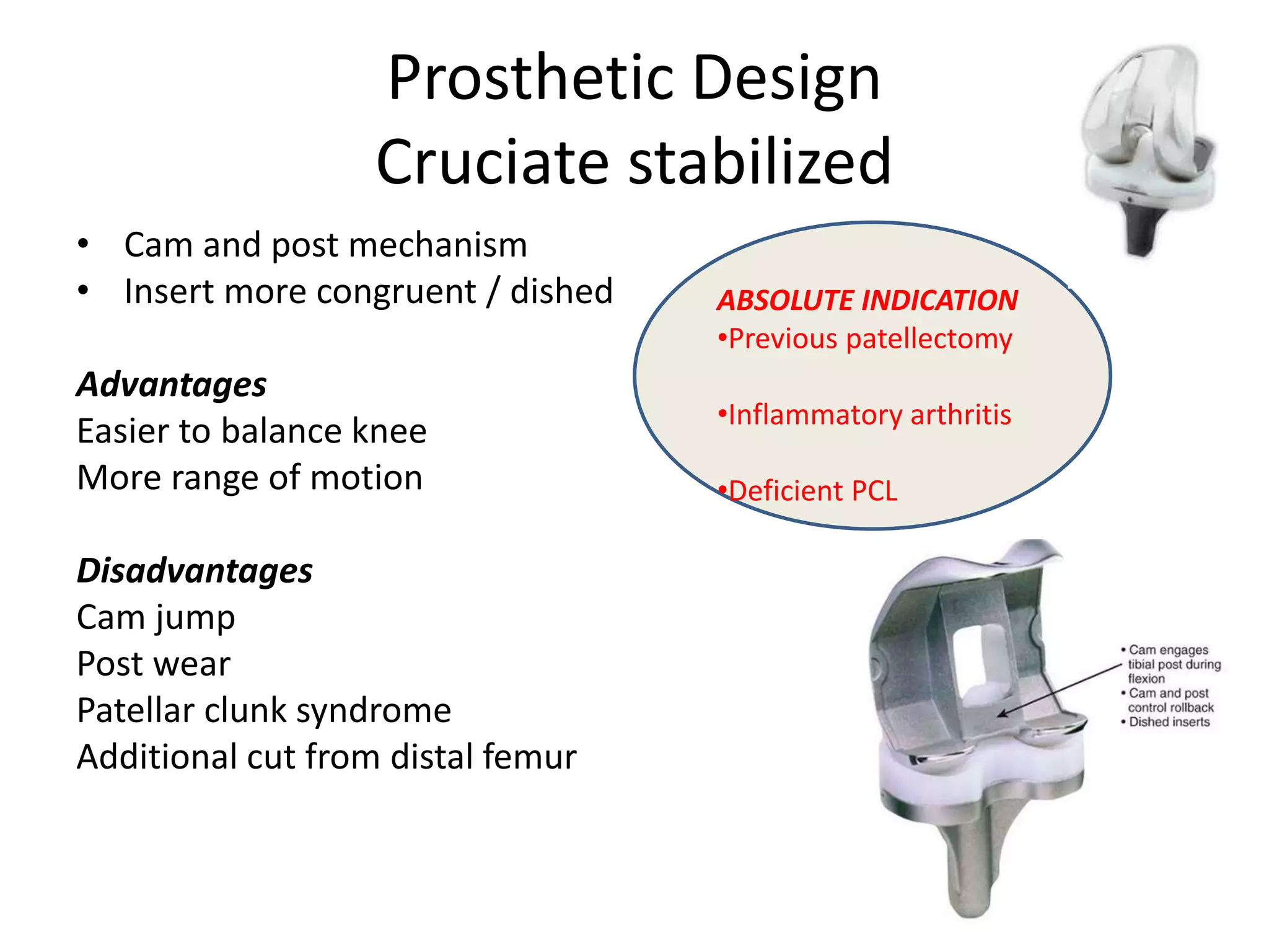 Primary total knee arthroplasty | PPTX