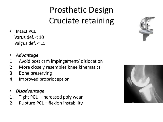 Primary total knee arthroplasty