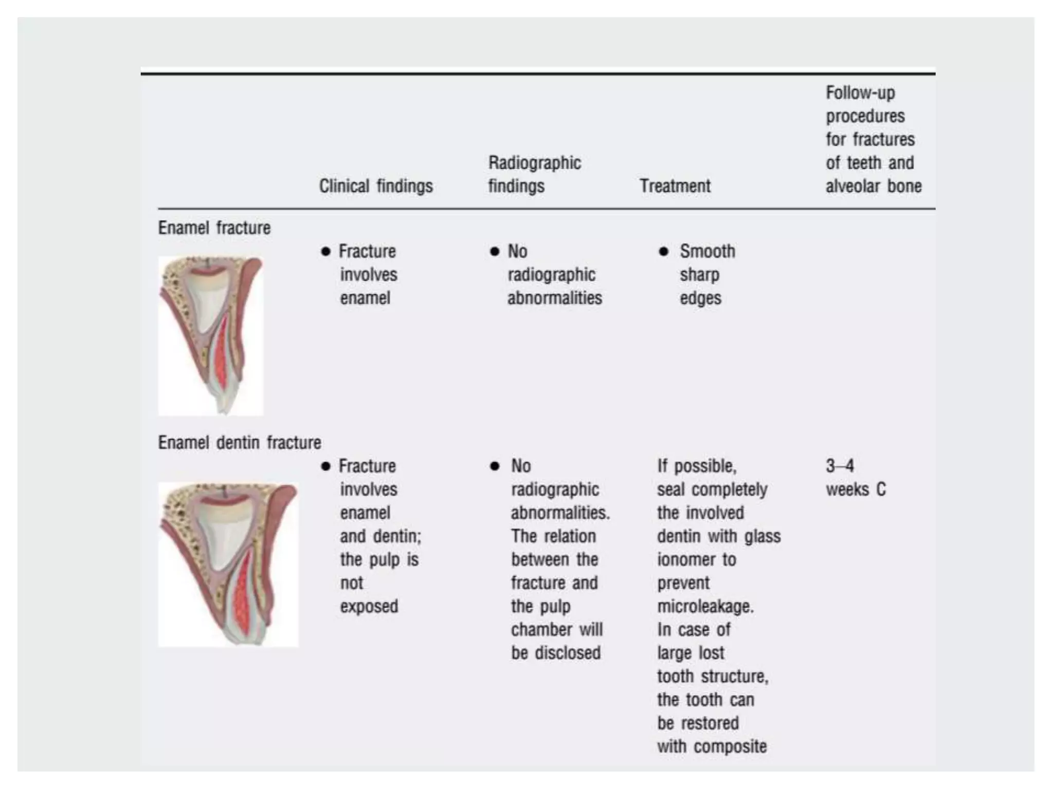 Primary teeth trauma managment | PPTX