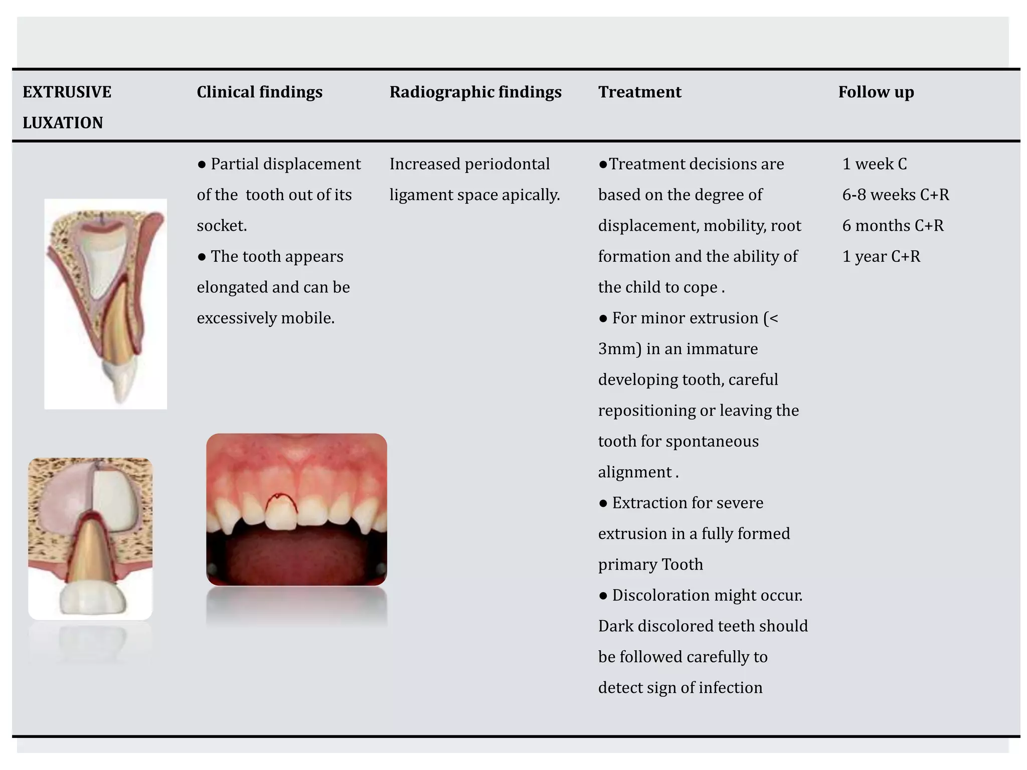 Primary teeth trauma managment | PPTX