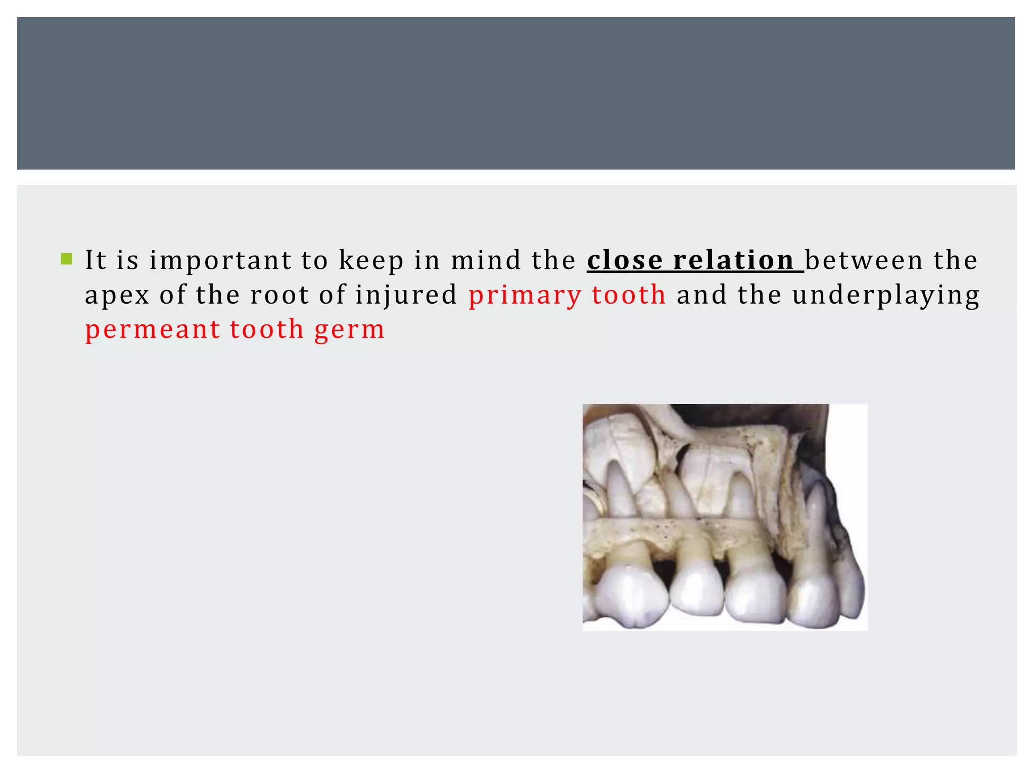 Primary teeth trauma managment | PPTX
