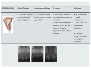 Primary teeth trauma managment | PPTX