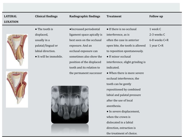 Primary teeth trauma managment | PPTX
