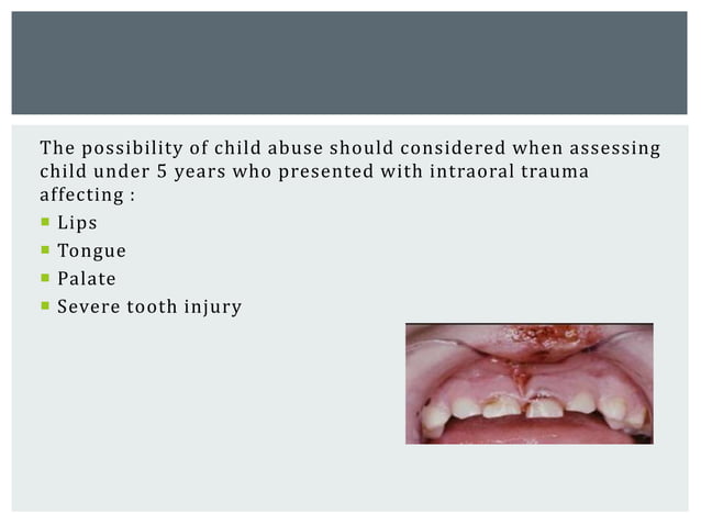 Primary teeth trauma managment | PPTX