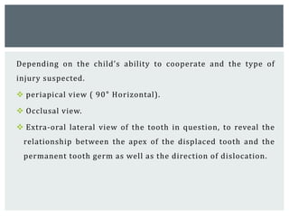 Primary teeth trauma managment | PPTX