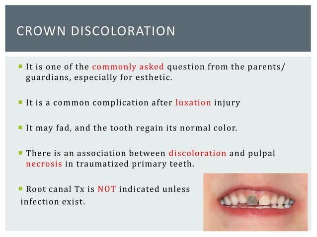 Primary teeth trauma managment | PPTX