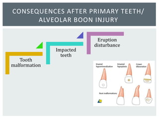 Primary teeth trauma managment | PPTX