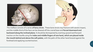 Primary trauma care | PPTX