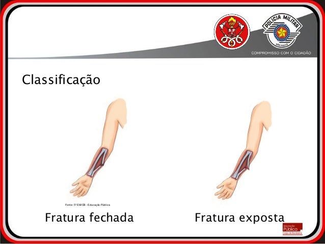NOÇÕES DE PRIMEIROS SOCORROS