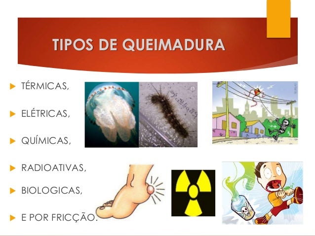 Primeiros socorros - Queimaduras