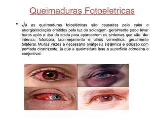 PRIMEIROS SOCORROS CHOQUE ELETRICO | PPT
