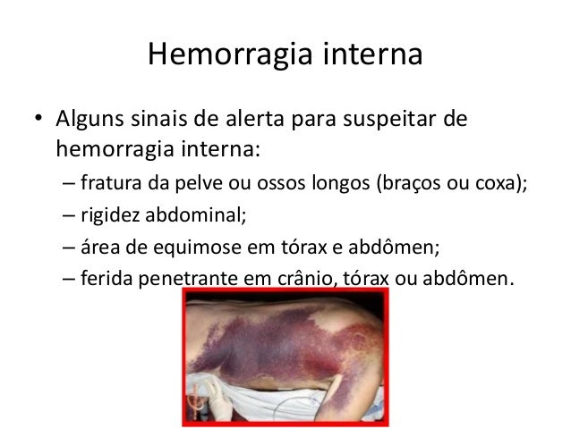 Primeiros socorros (PRS 71) - Hemorragia