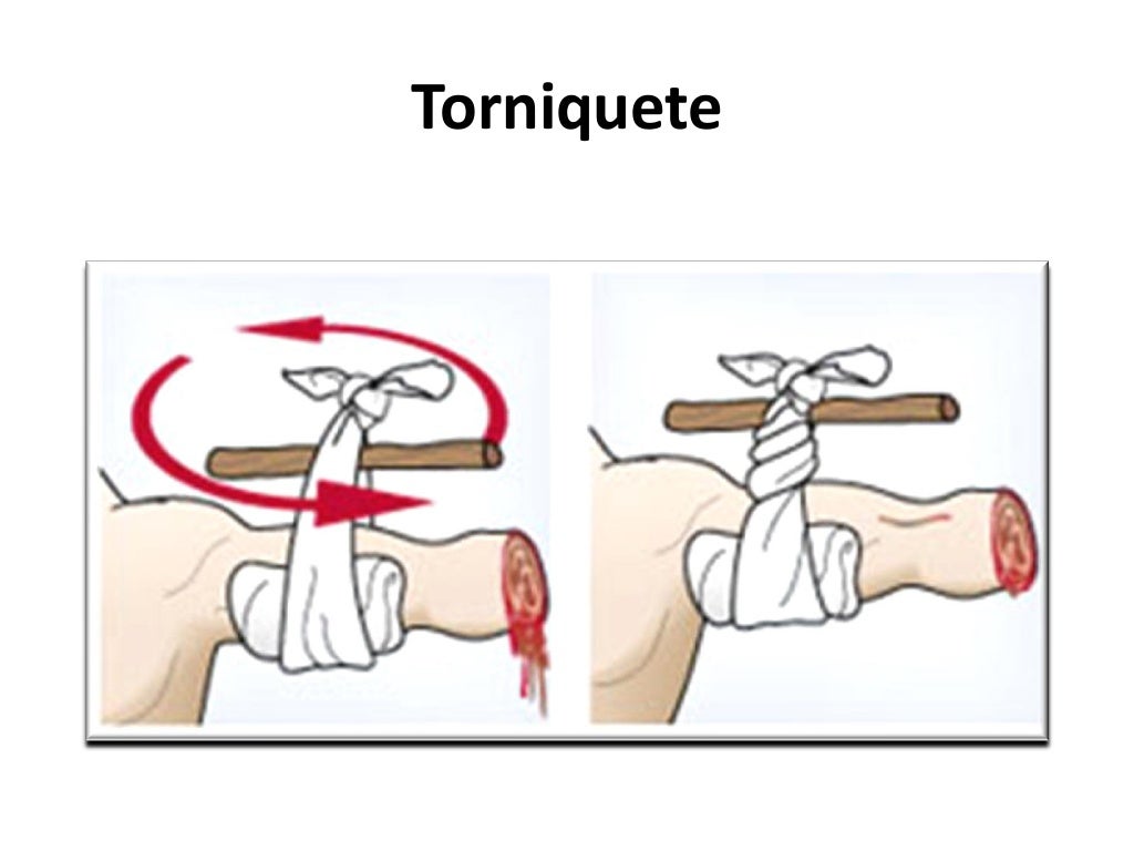 Primeiros Socorros Hemorragia Externa - RETOEDU