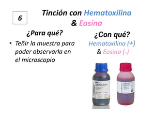 Técnicas histológicas. Tinciones. Hematoxilina y Eosina | PPTX