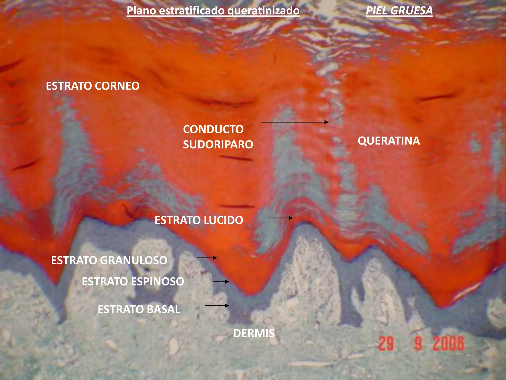 Primera parte del examen practico de laminas de genetica e ...