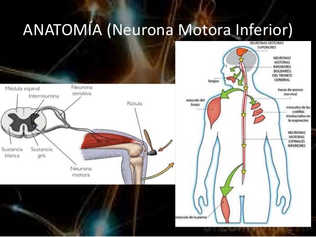 Síndrome de neurona motora superior e inferior