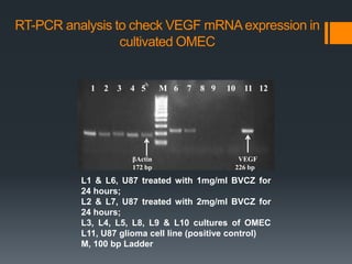 Primer designing for pcr and qpcr and their applications | PPT