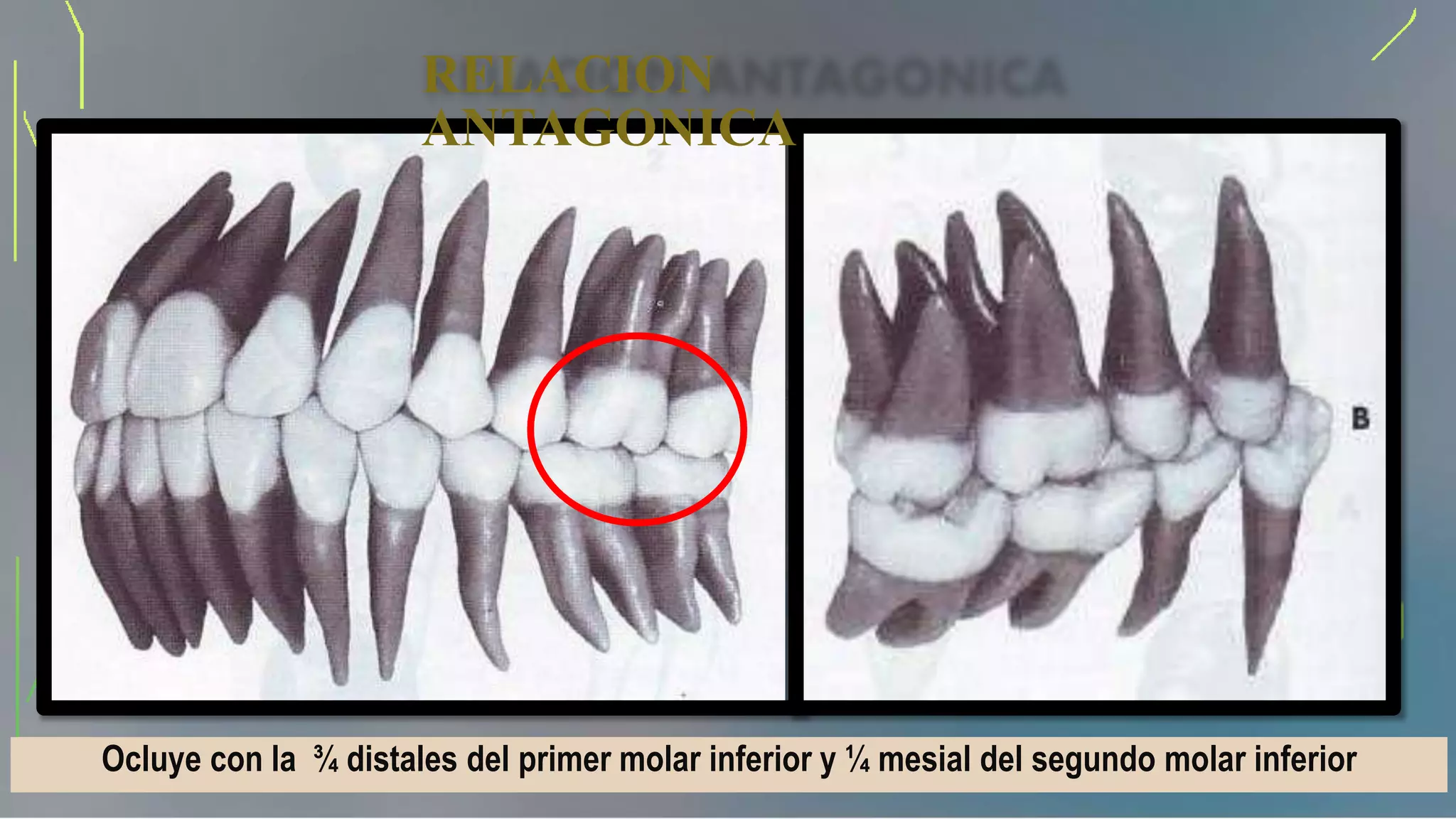 Primer molar superior | PPTX | Ear, Nose and Throat Conditions ...