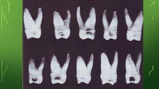 Primer molar superior | PPTX