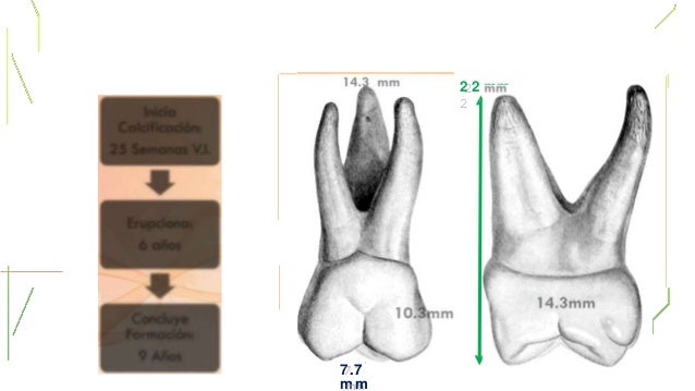 Primer molar superior